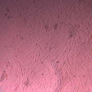 Human Dermal Fibroblasts